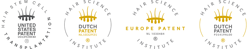 Hair transplantation for women - HASCI Jakarta